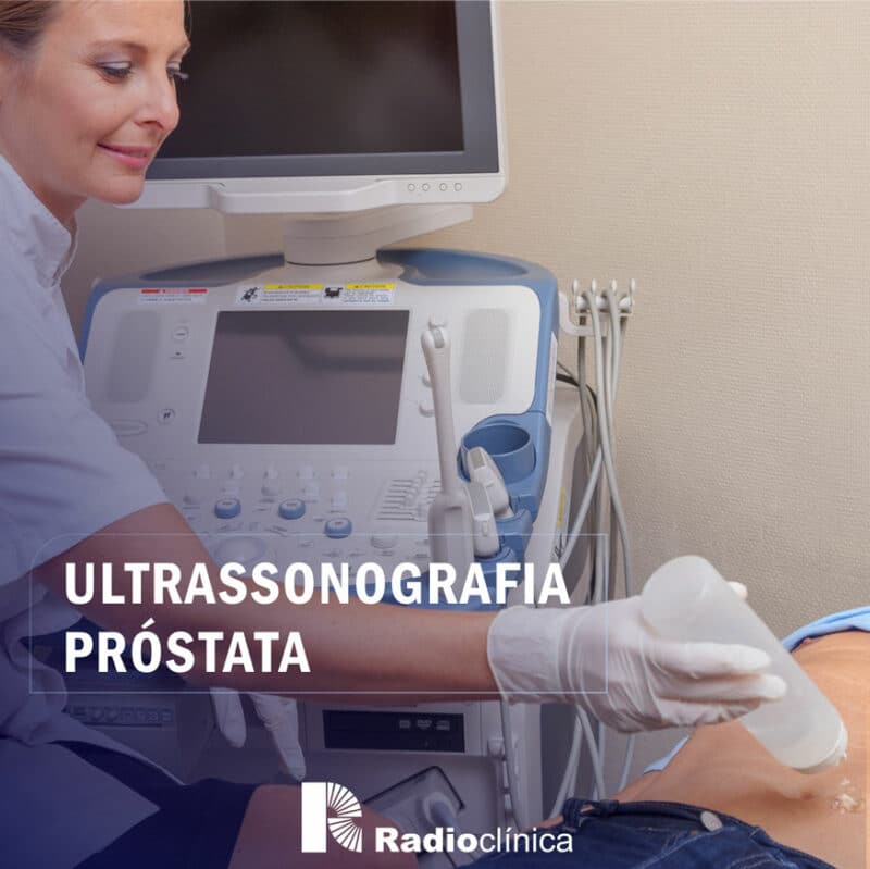 Ultrassonografia De Próstata Radioclínica Clínica De Imagem